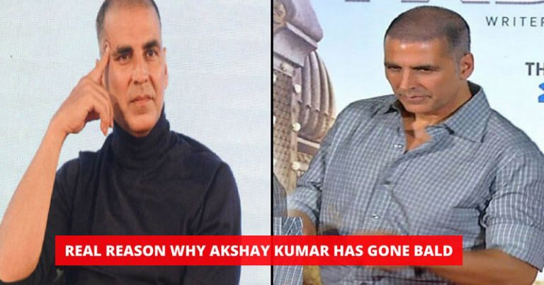 Check Out The Real Reason Behind The Bald Look Of Akshay Kumar